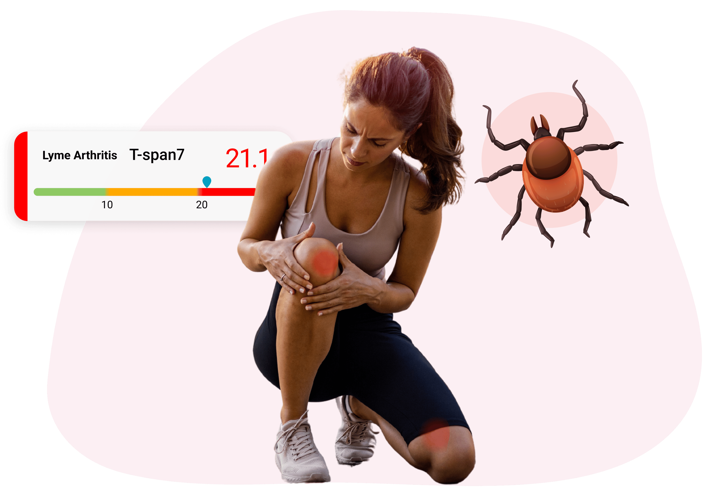 Lyme Disease Autoimmune Reactivity Panel Vibrant Wellness Lyme Disease Autoimmune Reactivity Panel Vibrant Wellness