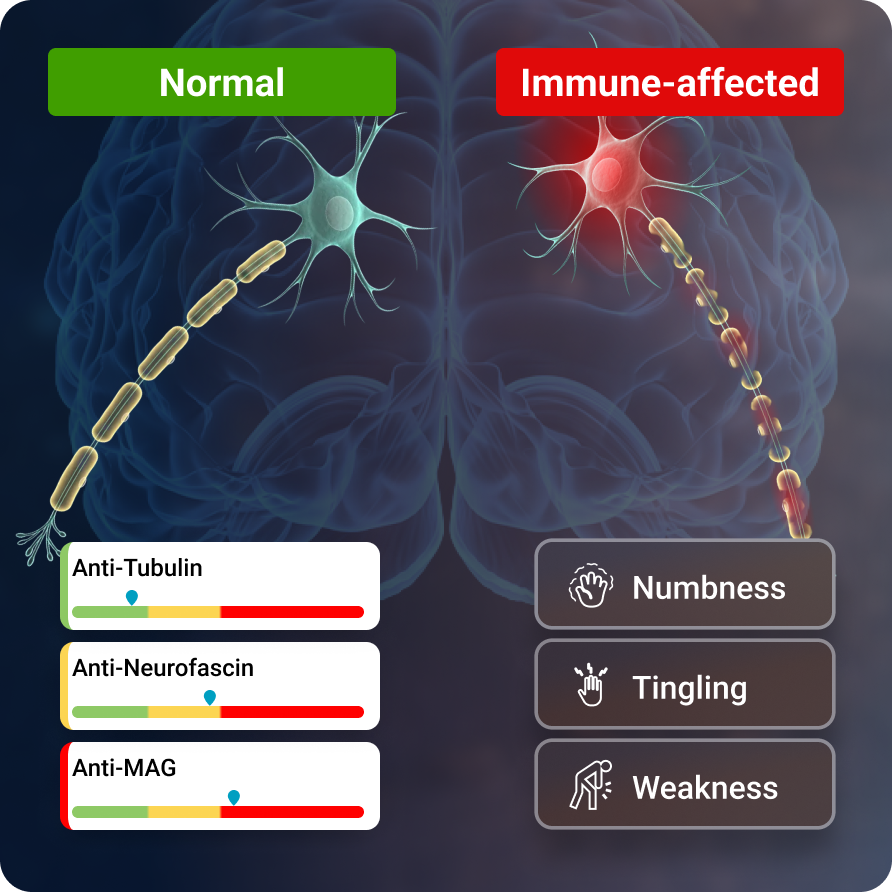 Neural Zoomer | Neural Autoimmunity & Brain Health | Vibrant Wellness