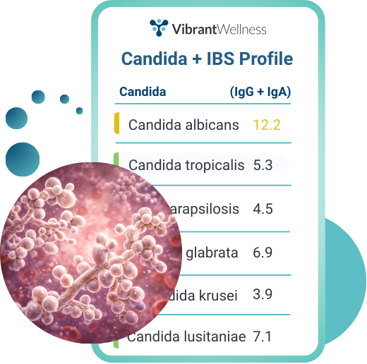 Infection Tests | Lyme & Tickborne Testing | Viral Infections | Candida+IBS
