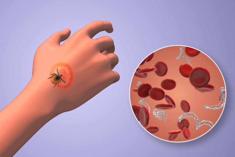 Tickborne Disease & Co-infection Testing | Vibrant Wellness